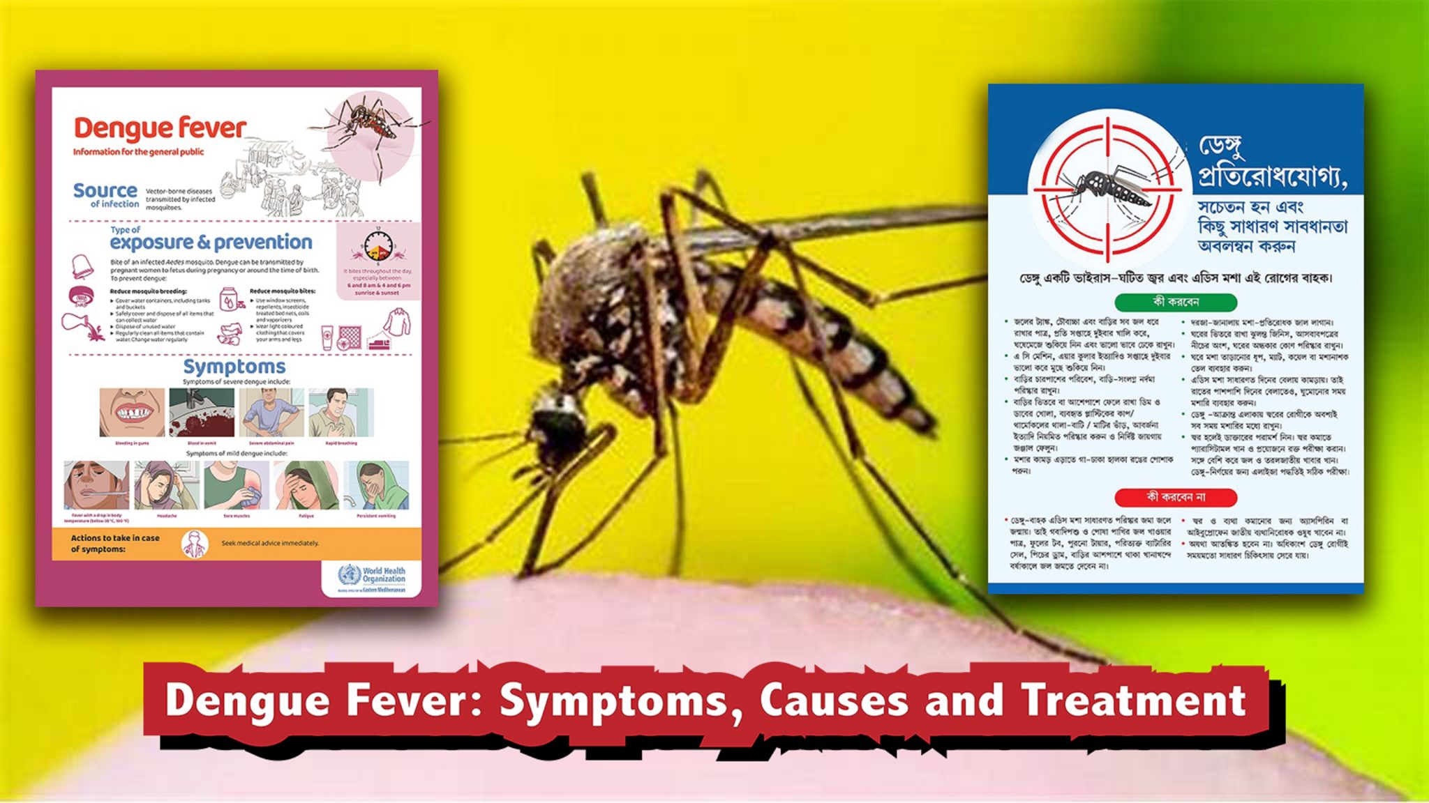 Dengue Fever: Symptoms, Causes and Treatment